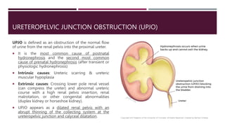Congenital Anomalies of the Kidney & Urinary Tract | PPTX