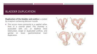 Congenital Anomalies of the Kidney & Urinary Tract | PPTX