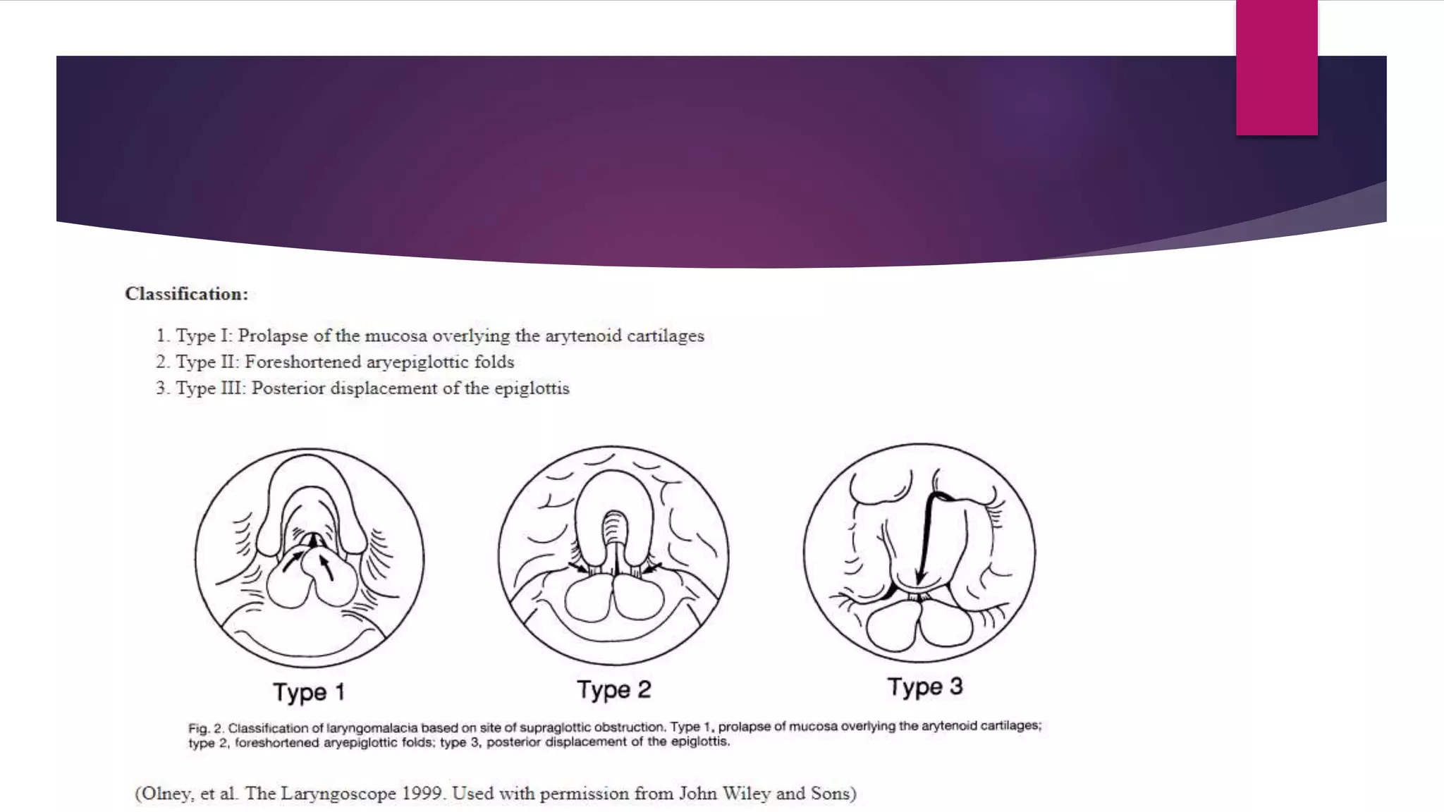 Congenital anomalies of the larynx | PPTX