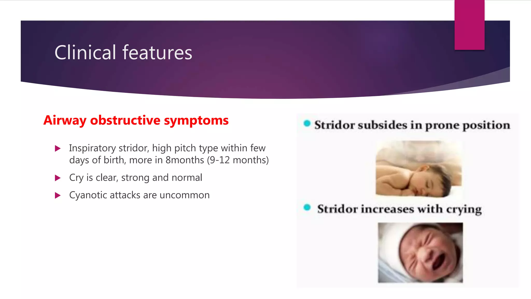Congenital anomalies of the larynx | PPTX