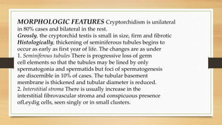 Congenital Anomalies Of UG System PATHOLOGY.pptx