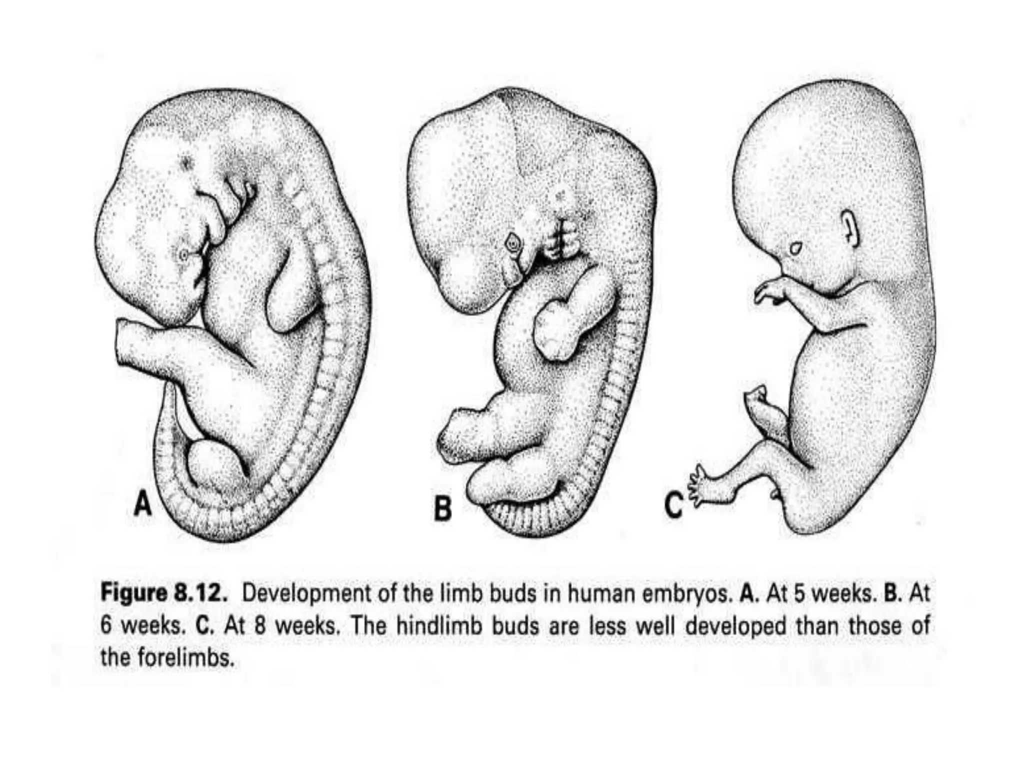 Congenital anomalies of upper limb | PPTX
