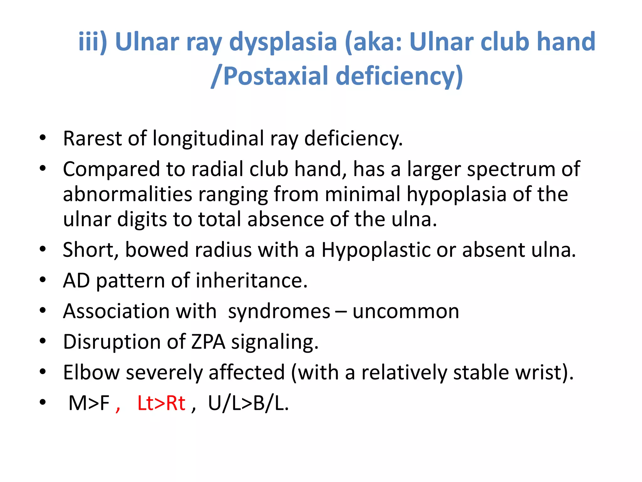 Congenital anomalies of upper limb | PPTX