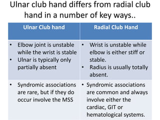 Congenital anomalies of upper limb | PPTX