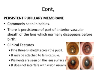 Congenital anomalies ro | PPTX