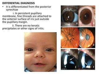 Congenital anomalies ro | PPTX