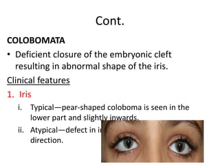 Congenital anomalies ro | PPTX