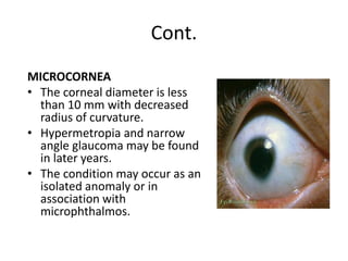 Congenital anomalies ro | PPTX