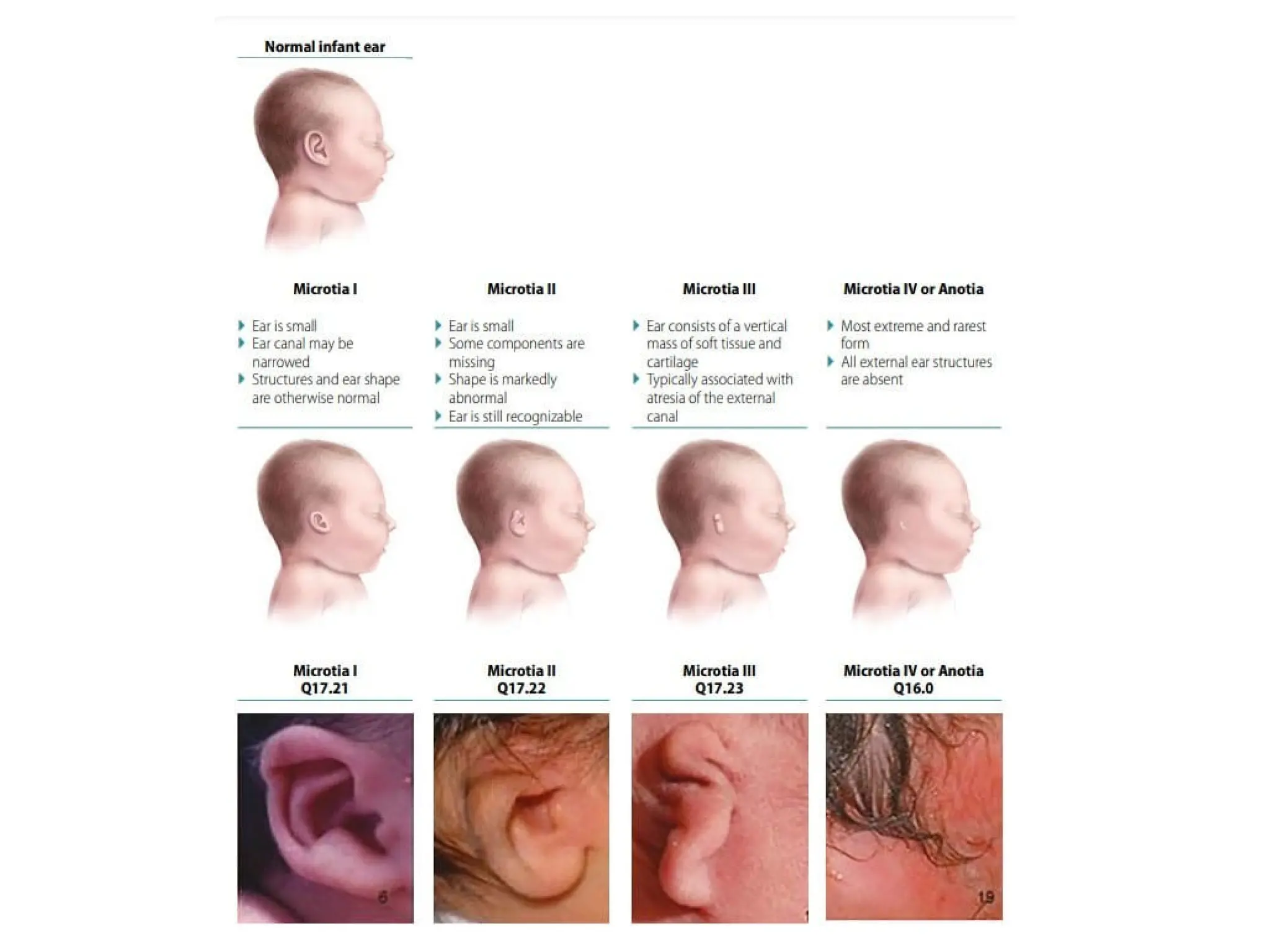 congenital anomaly and congenital deformity final 2.pptx