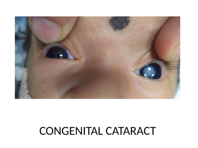 congenital anomaly and congenital deformity final 2.pptx