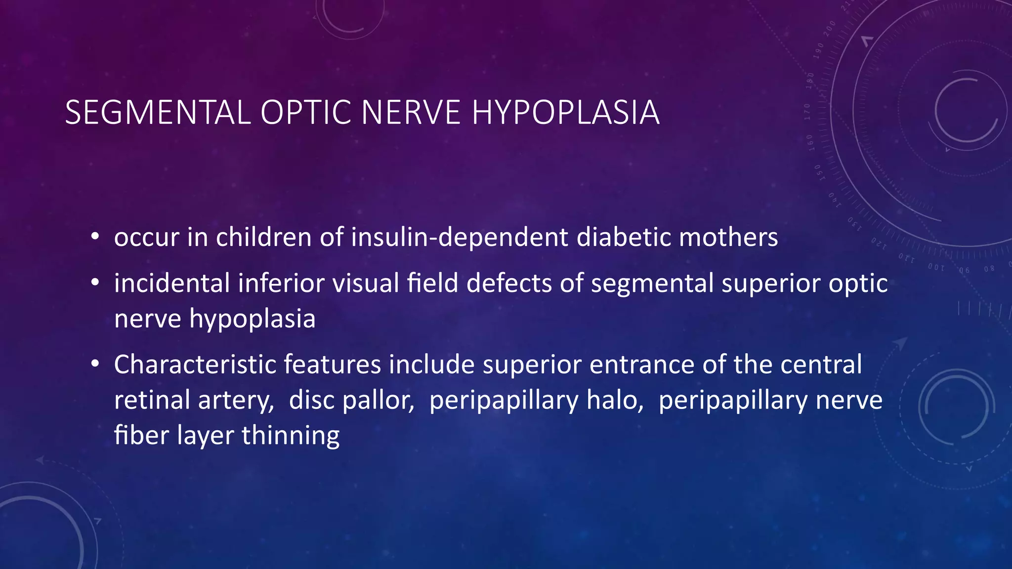 optic disc anomaly | PPTX