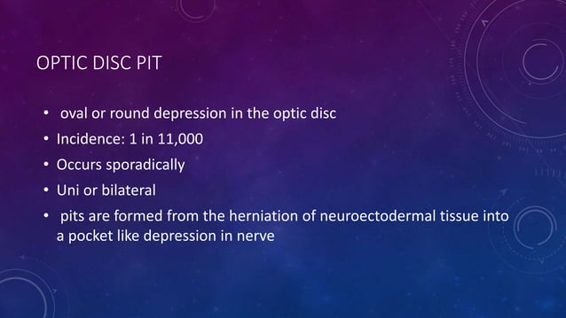 Optic Disc Anomaly Ppt
