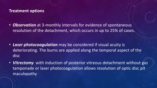optic disc anomaly | PPTX