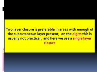 Congenital band syndrome | PPTX