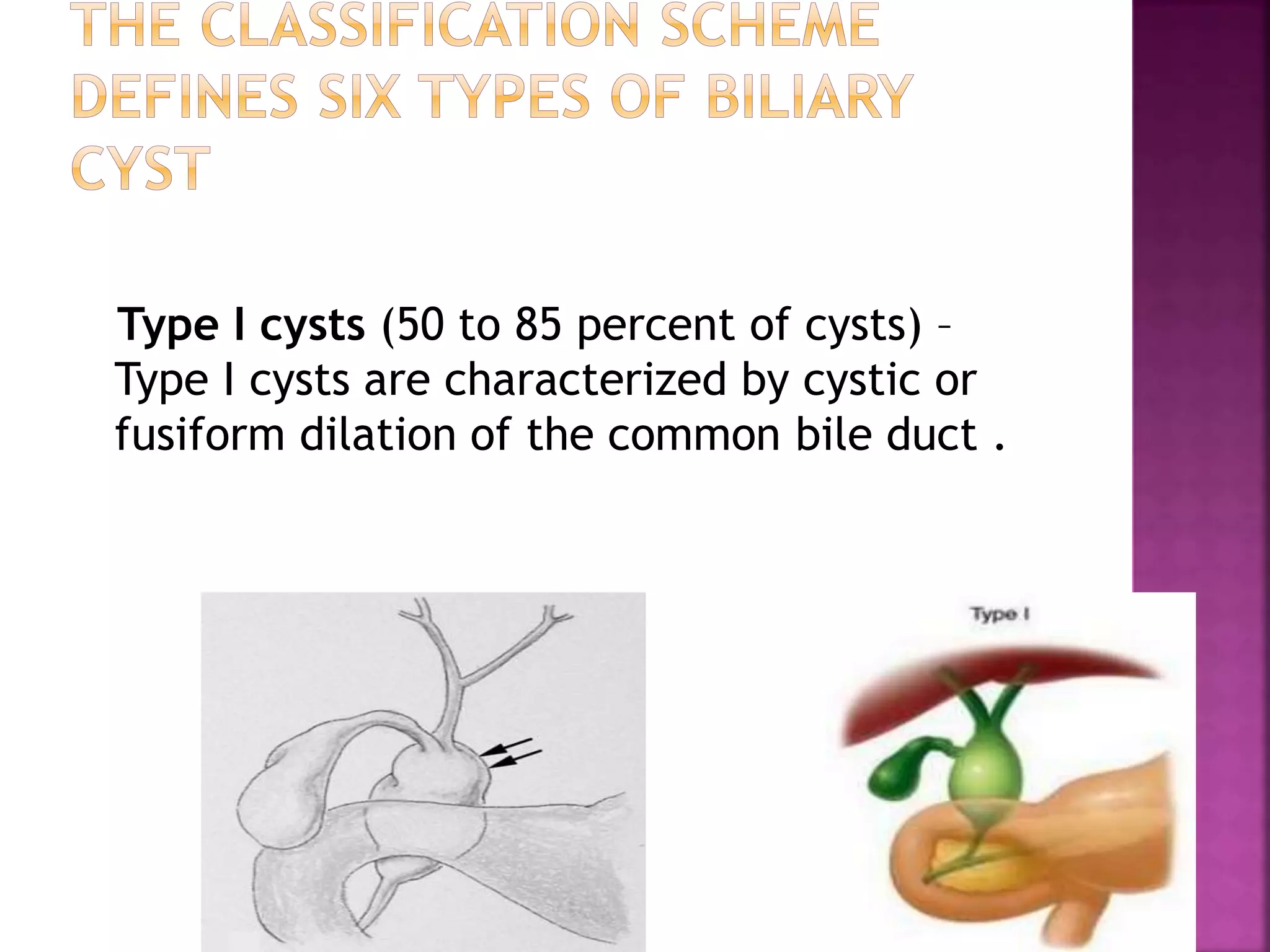 Congenital bile duct anomalies | PPTX