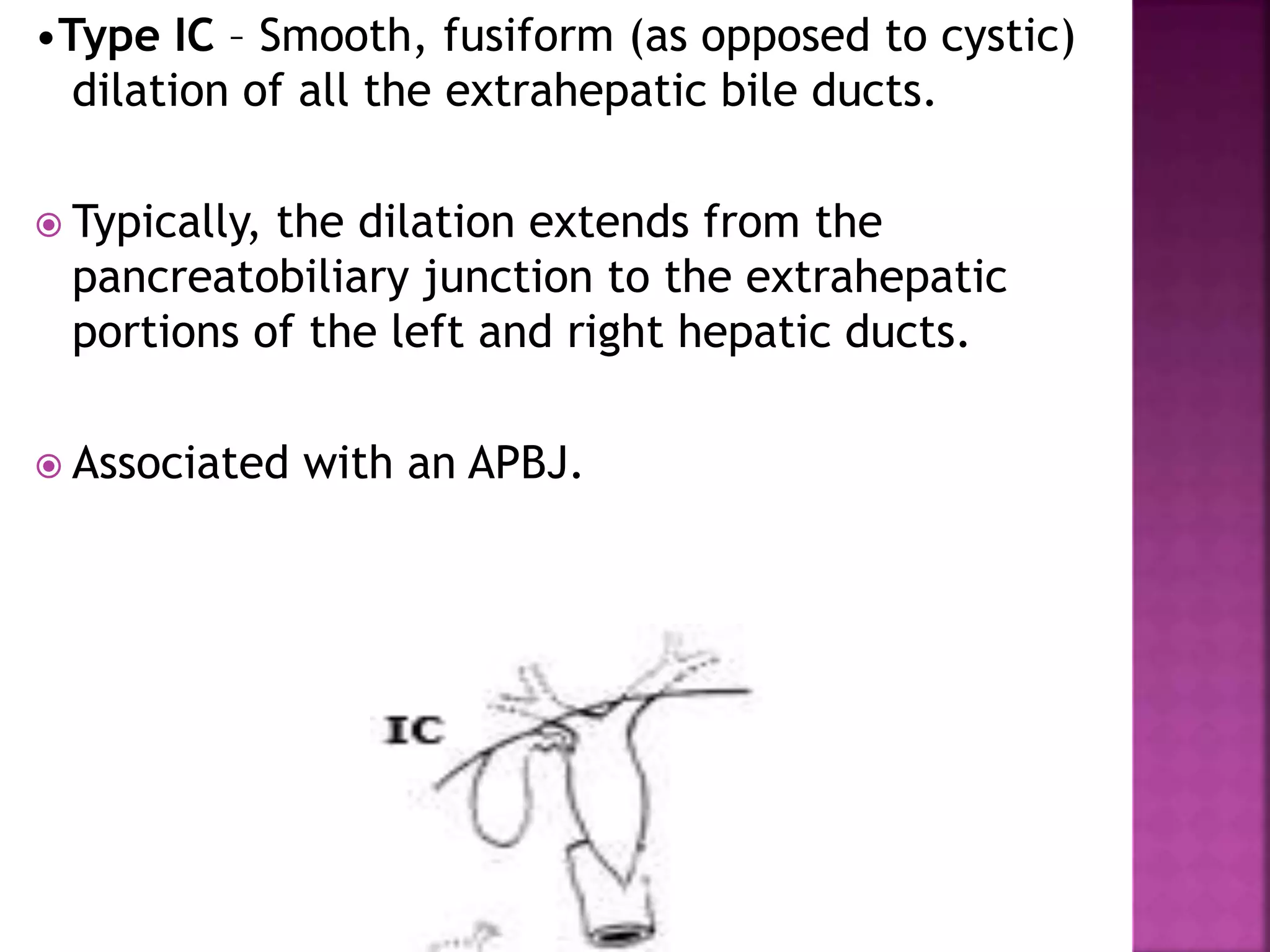 Congenital bile duct anomalies | PPTX