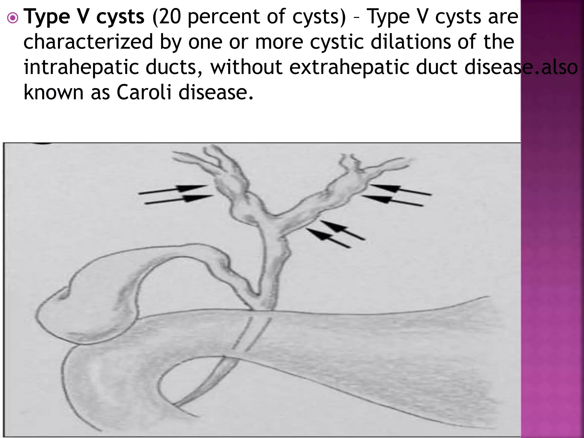 Congenital bile duct anomalies | PPTX