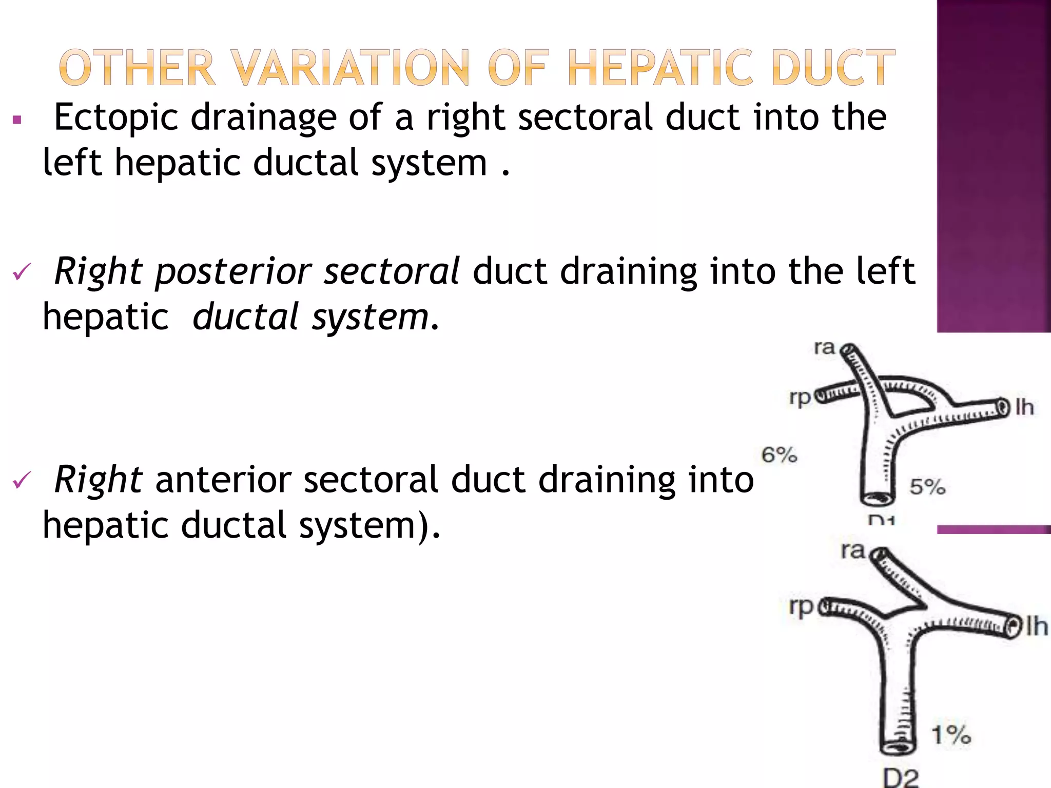 Congenital bile duct anomalies | PPTX