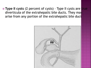 Congenital bile duct anomalies | PPTX