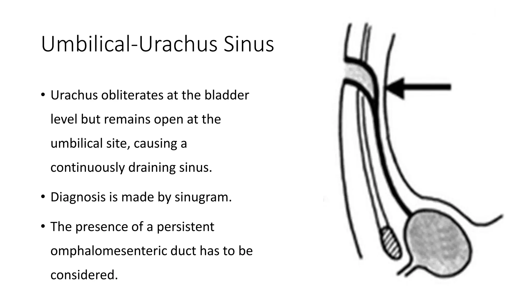 Congenital bladder disorders | PPTX