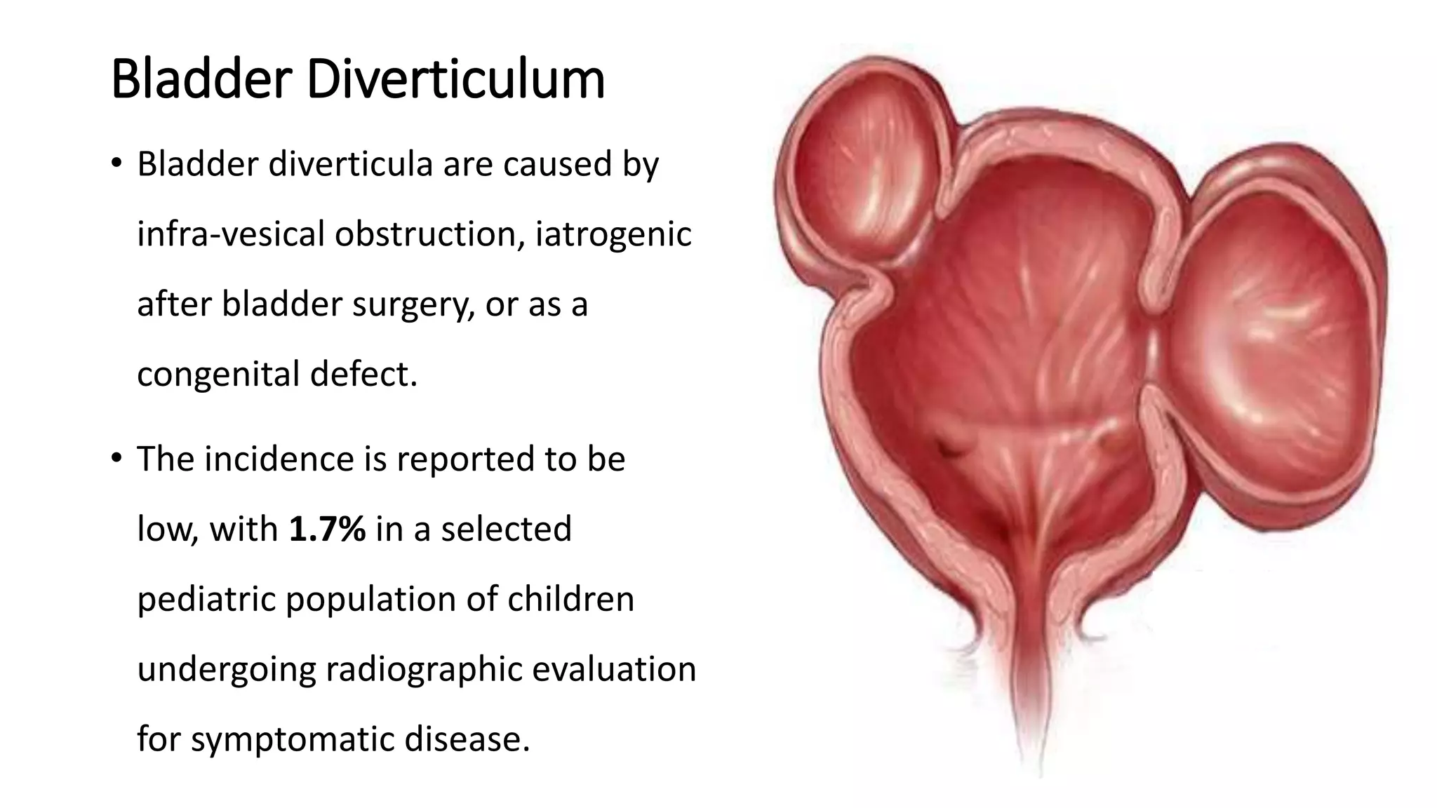 Congenital bladder disorders | PPTX
