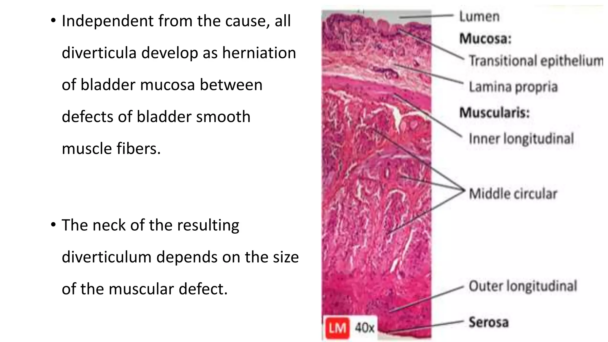 Congenital bladder disorders | PPTX
