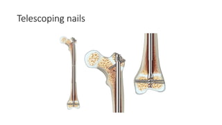 congenital bone and developmental disease of the bone.pptx