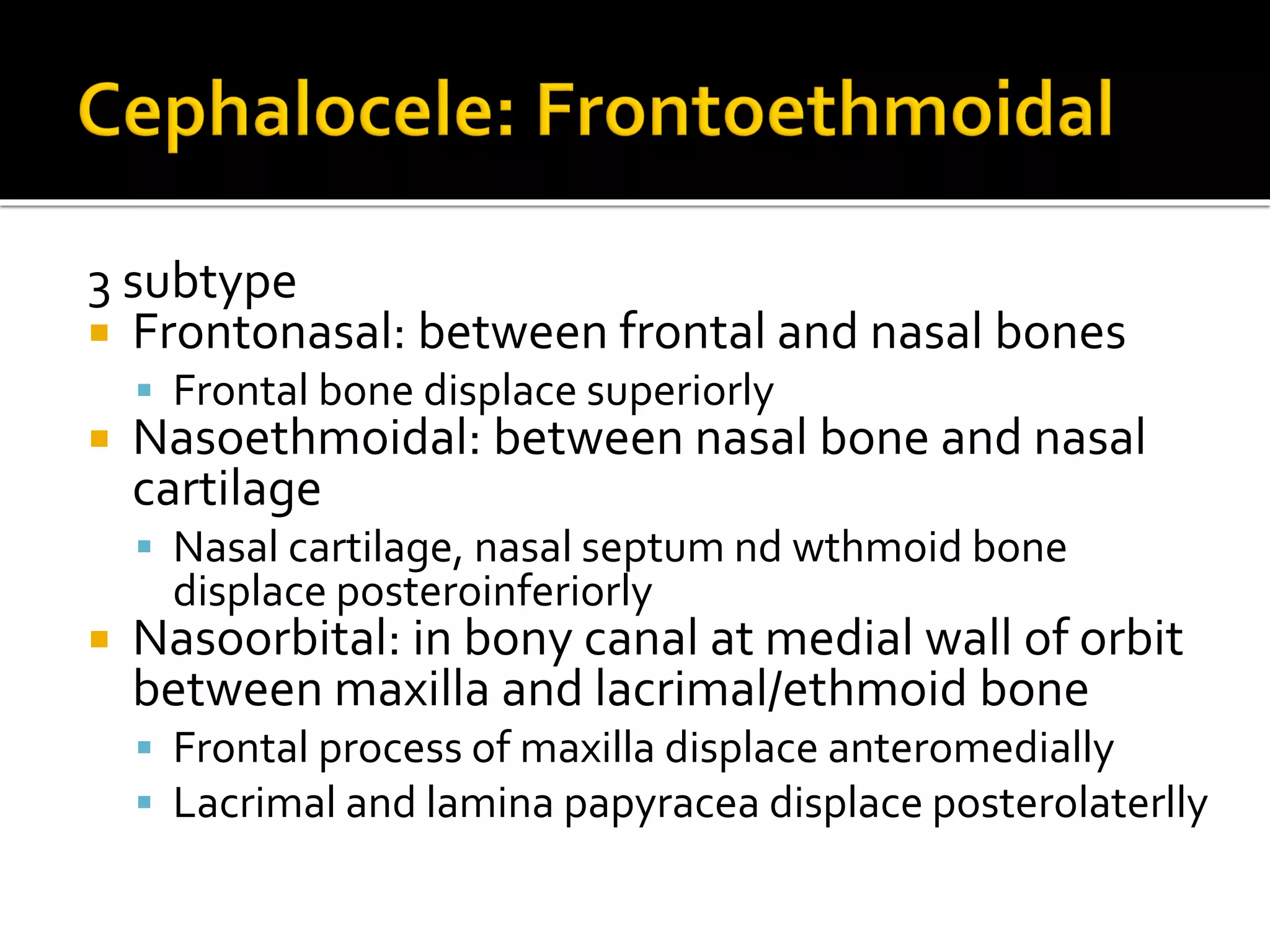 Congenital brain anomalies | PDF