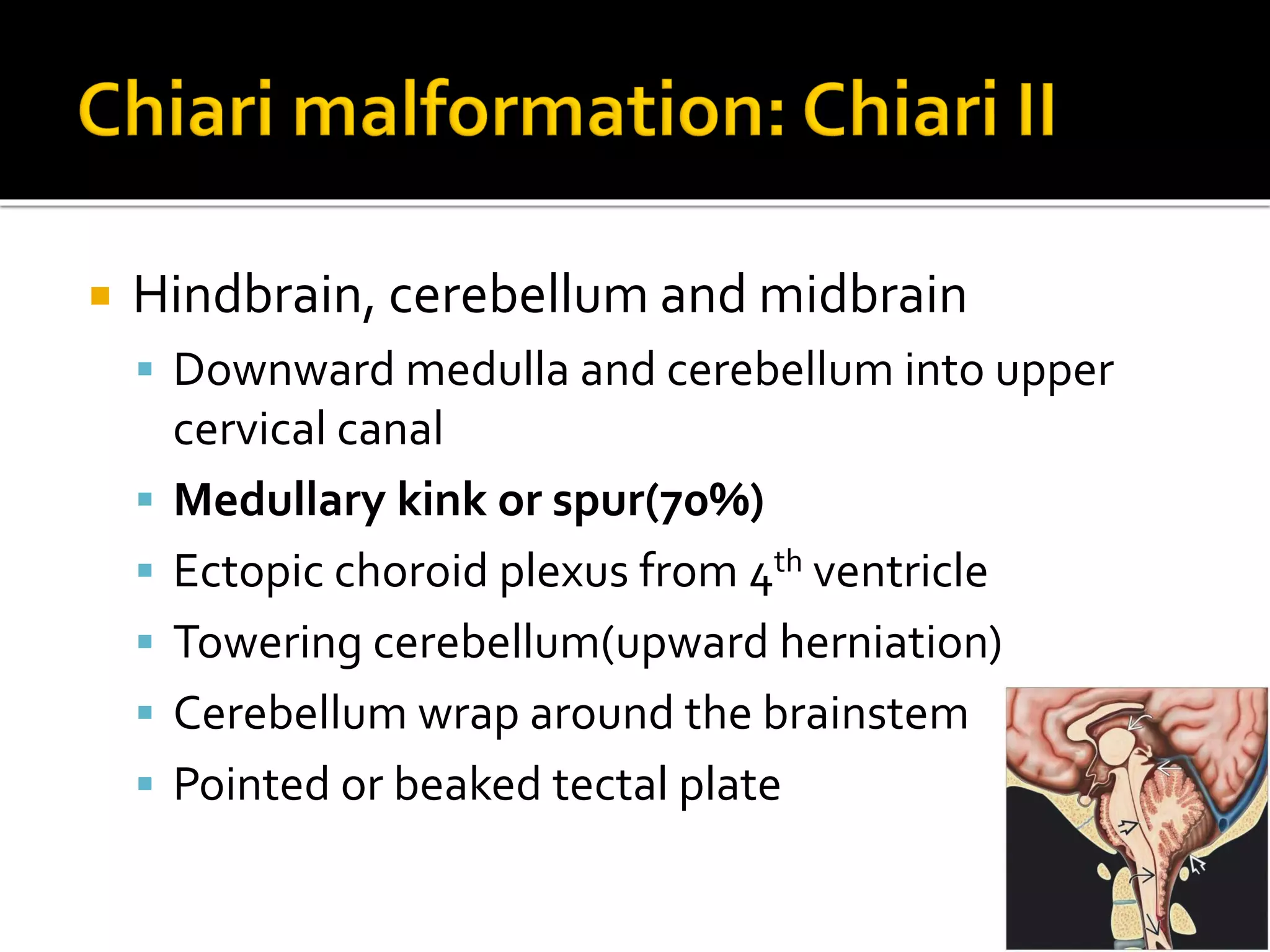 Congenital brain anomalies | PDF