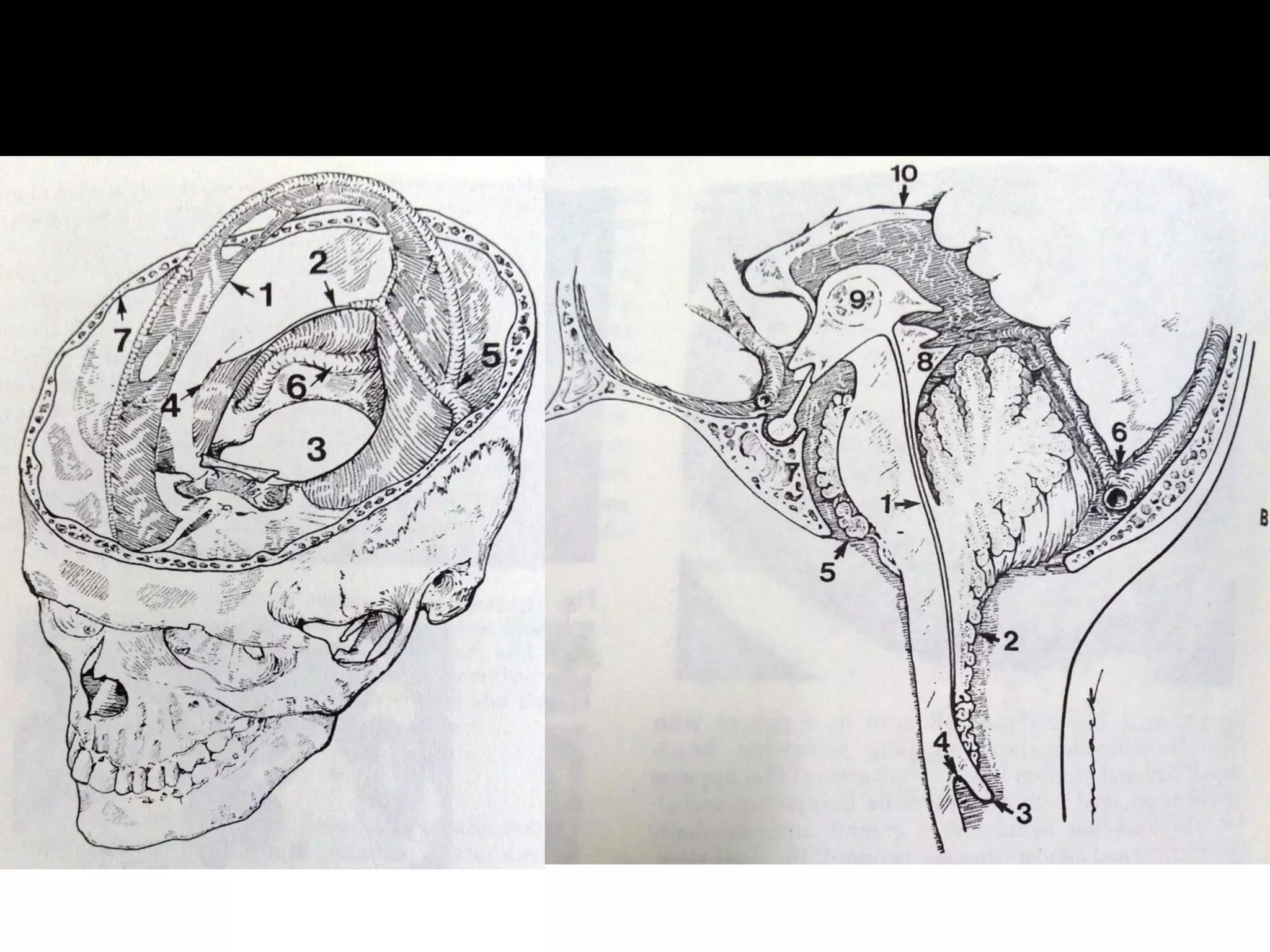 Congenital brain anomalies | PDF