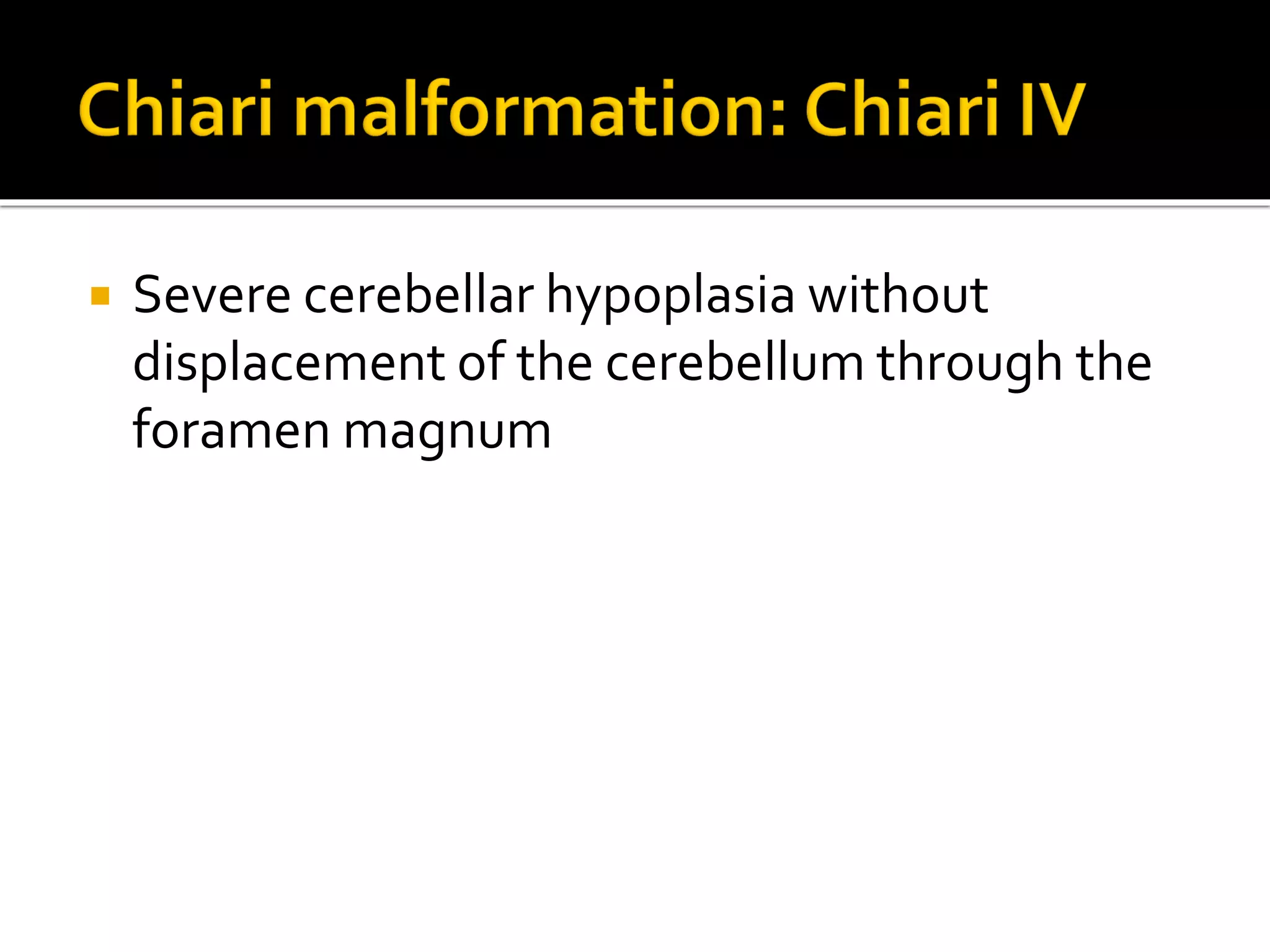 Congenital brain anomalies | PDF