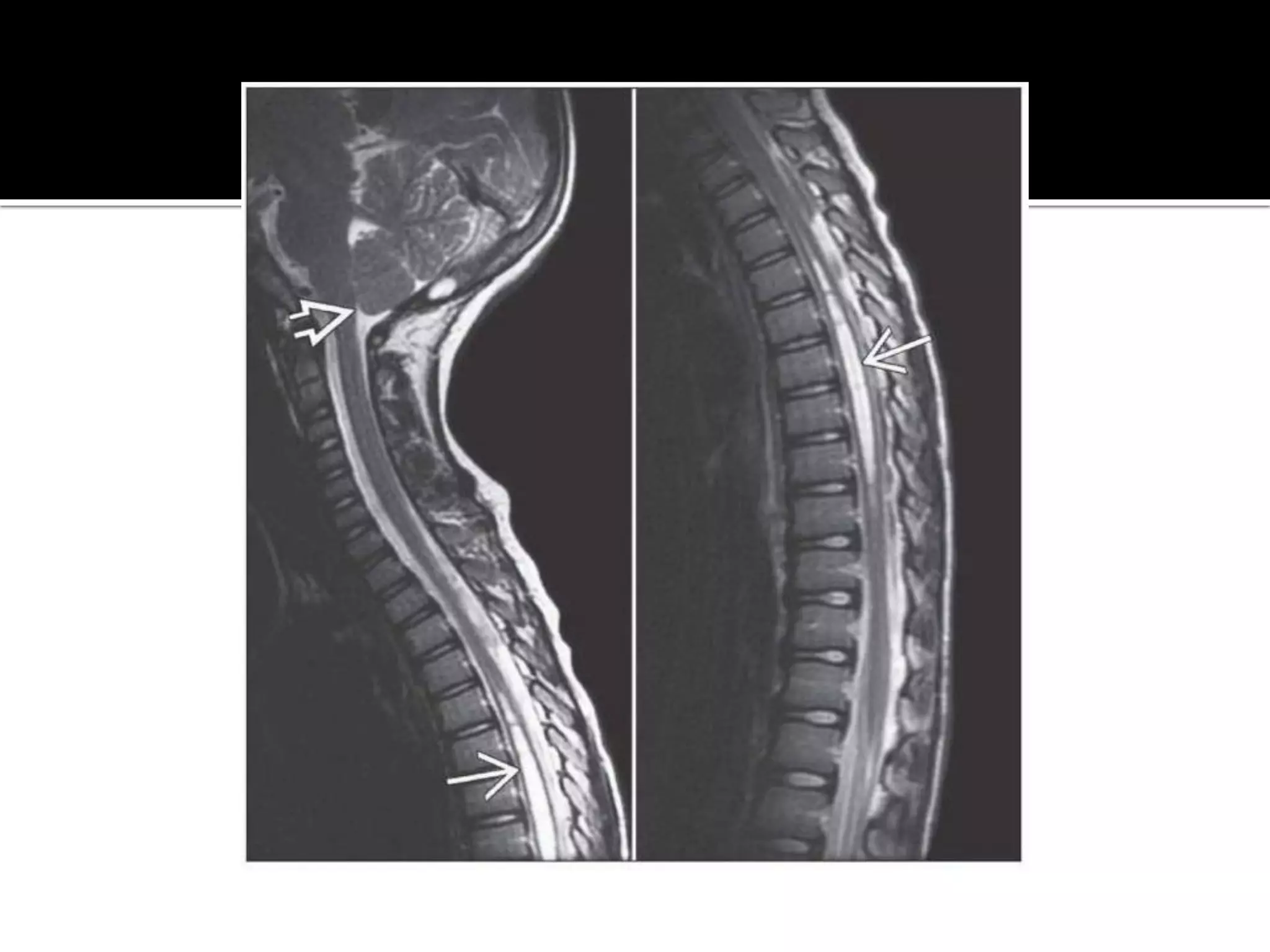 Congenital brain anomalies | PDF