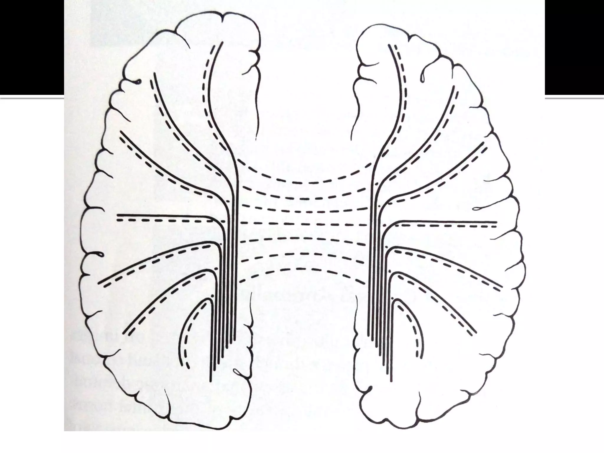 Congenital brain anomalies | PDF