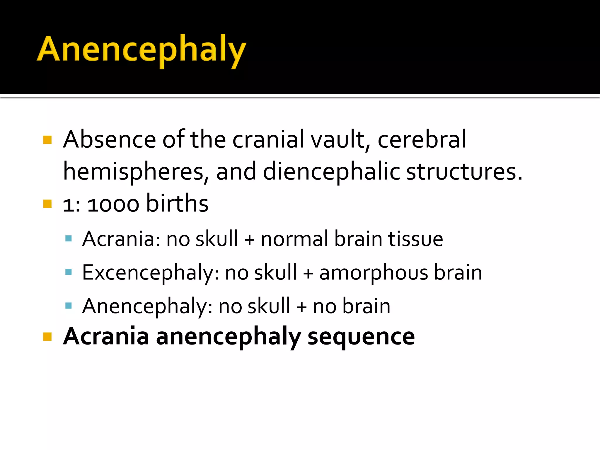 Congenital brain anomalies | PDF