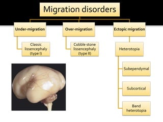 Congenital brain anomalies | PDF