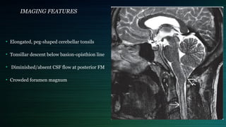 CONGENITAL BRAIN ANOMALIES for radiology.pptx