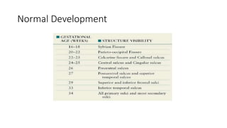 Congenital Brain Malformations - Reporting | PPT