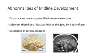 Congenital Brain Malformations - Reporting | PPT