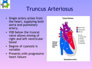 Congenital cardiac ...... lecture 61 18 4-2016 | PPT