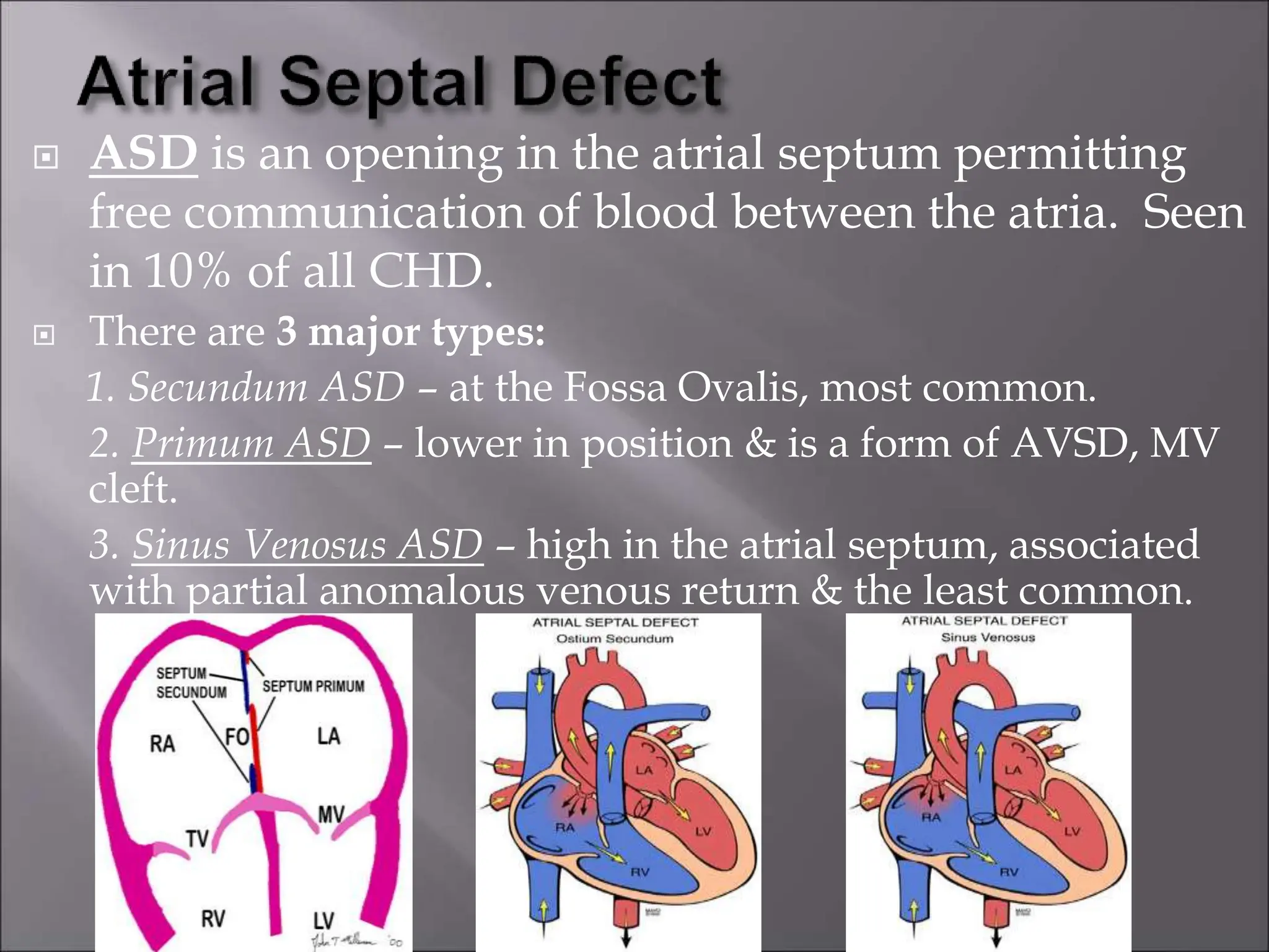 Congenital Cardiac Disease types and pathophysiology .ppt
