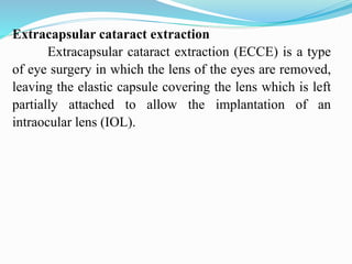 Congenital cataract | PDF