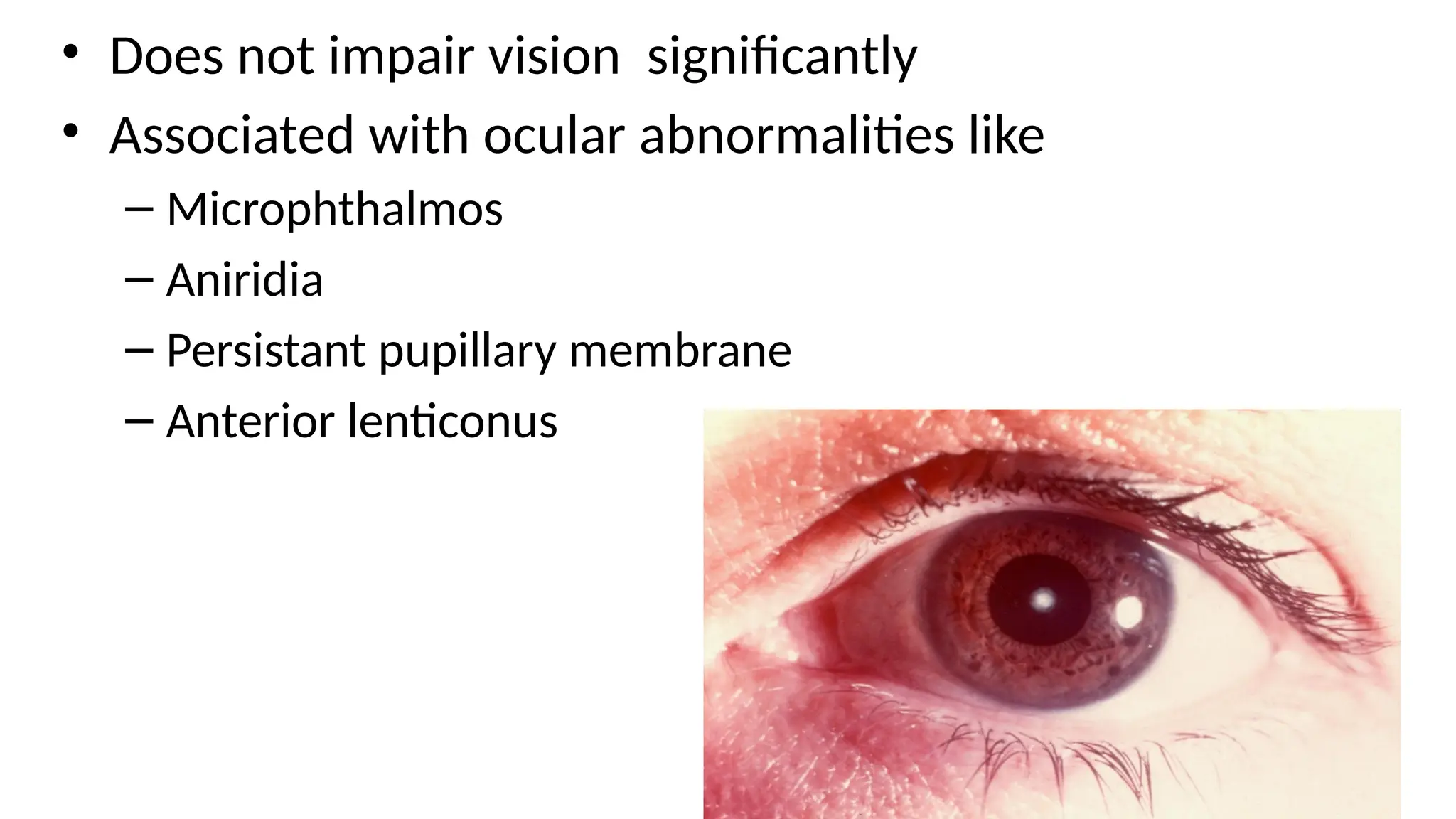 Congenital Cataract, Dr. Prabhat Devkota.pptx