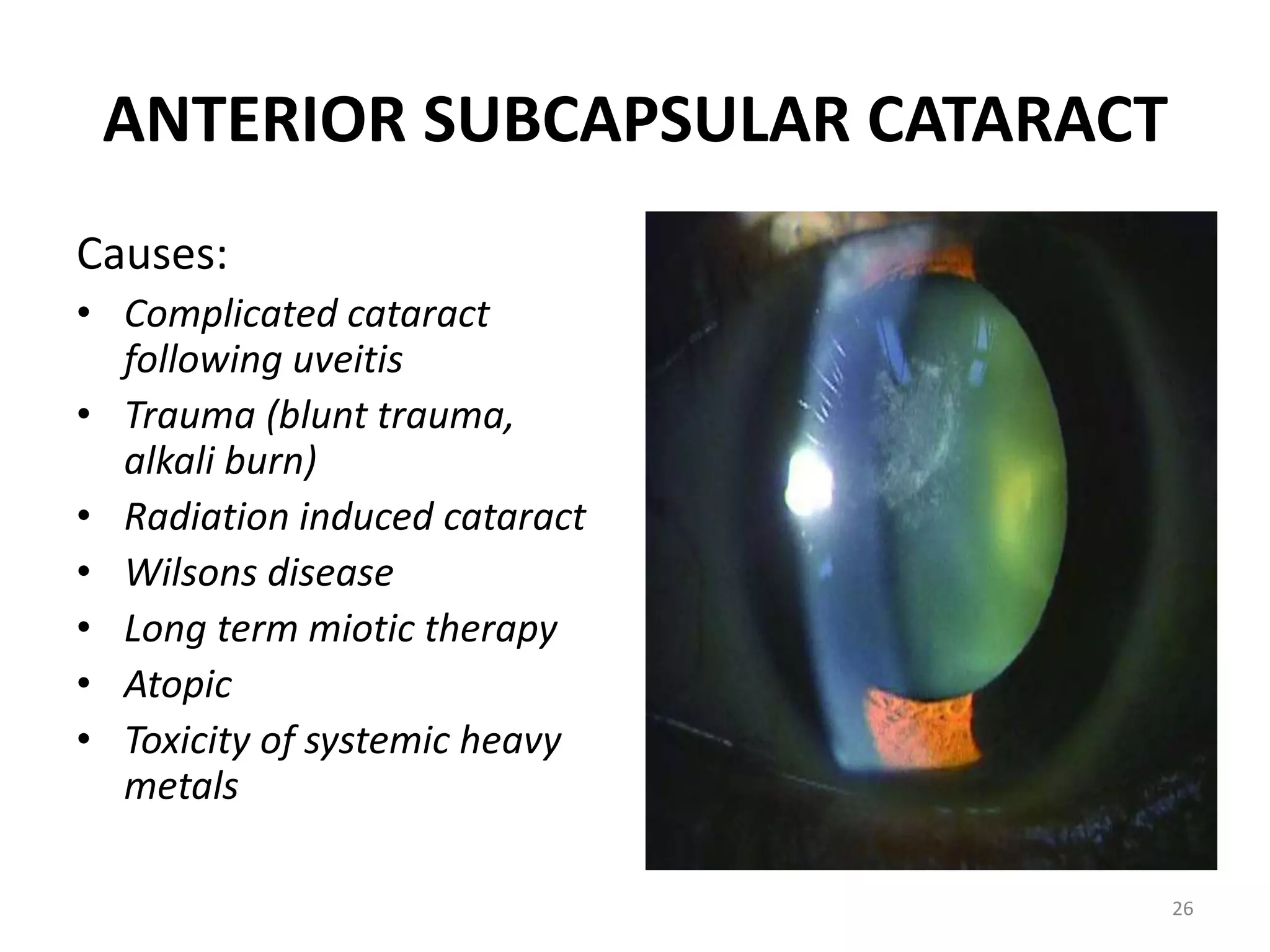 Congenital cataract | PPTX