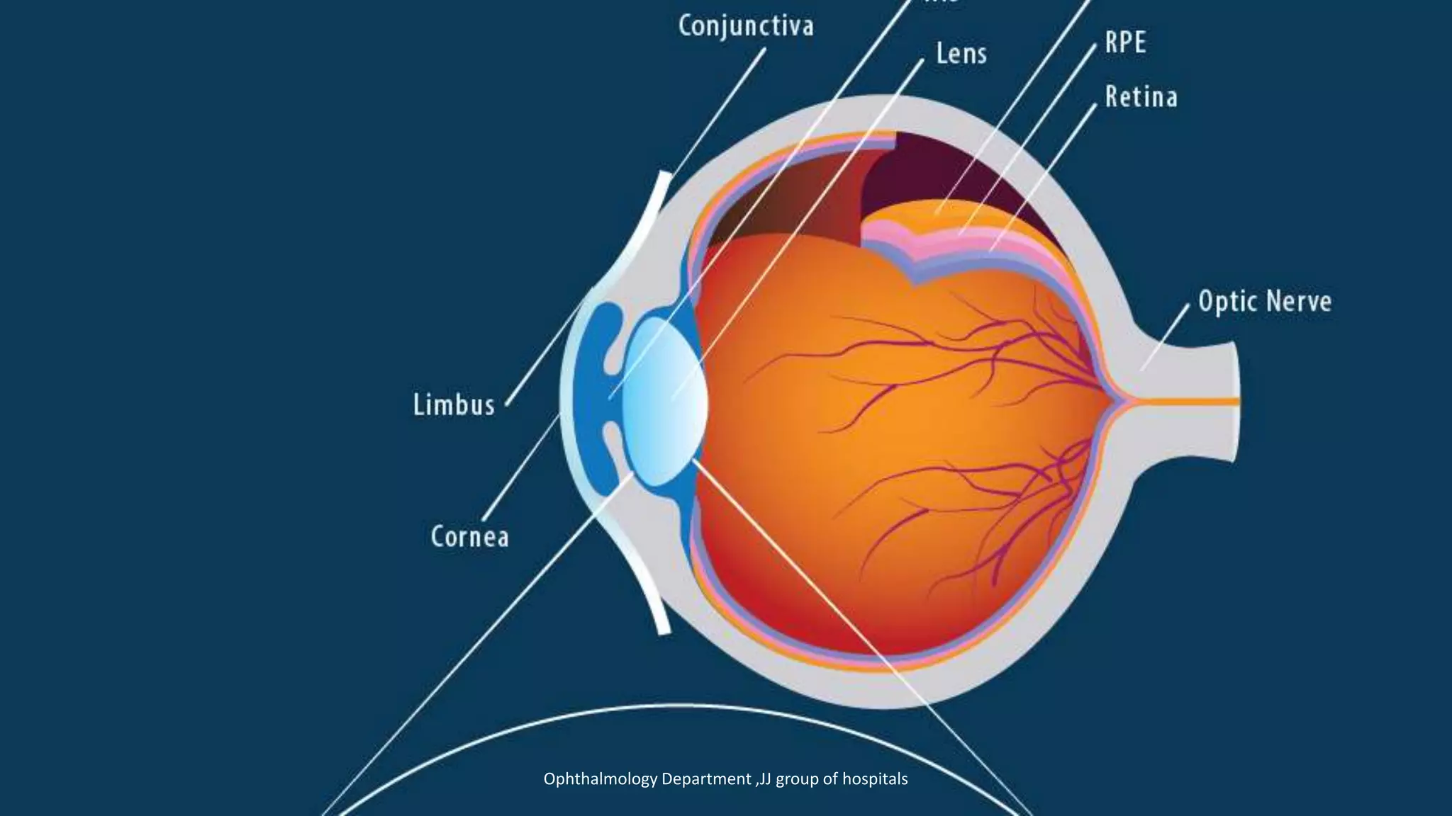 Pediatric (congenital, developmental) cataract and management ...