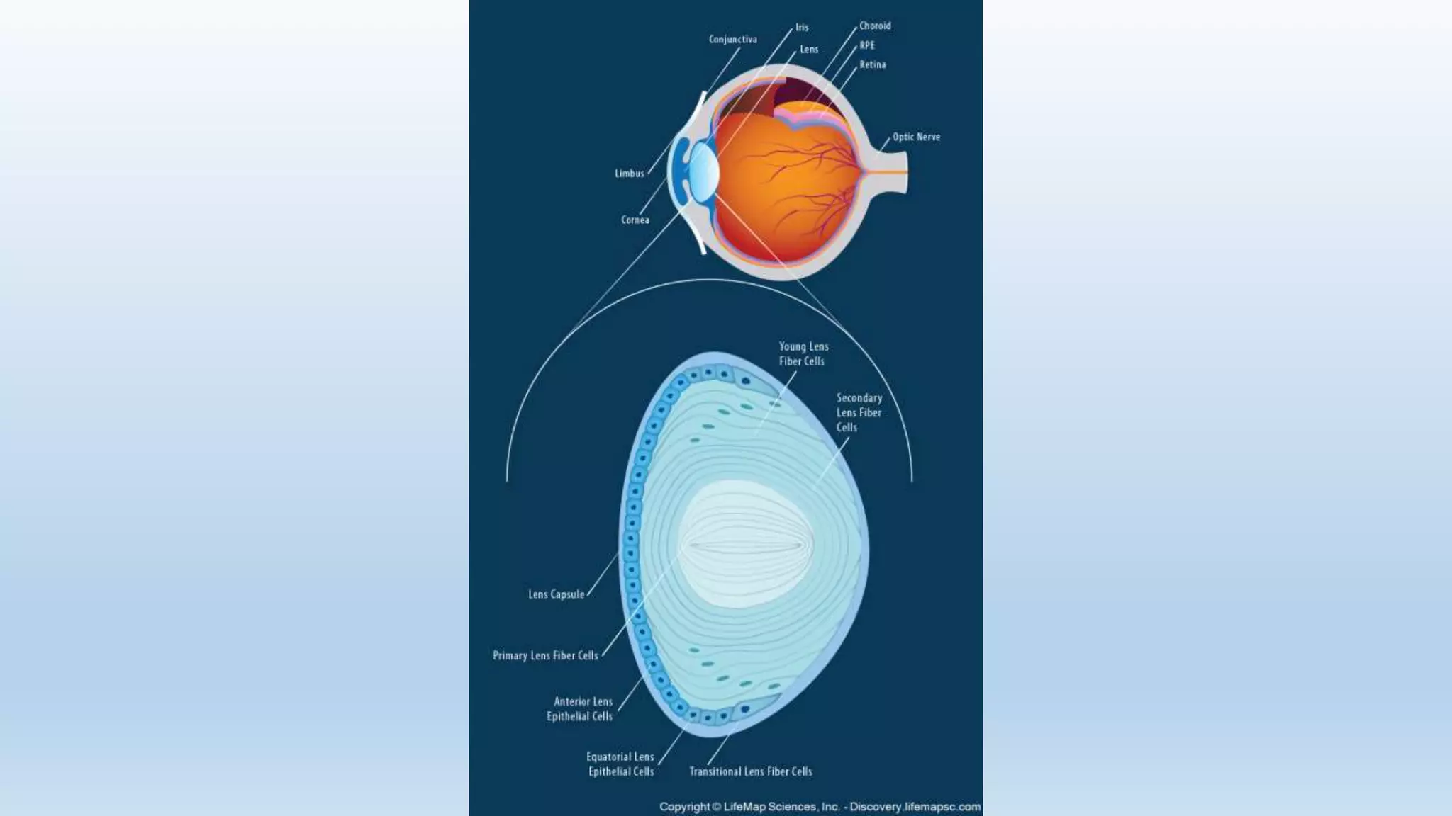 Pediatric (congenital, developmental) cataract and management ...