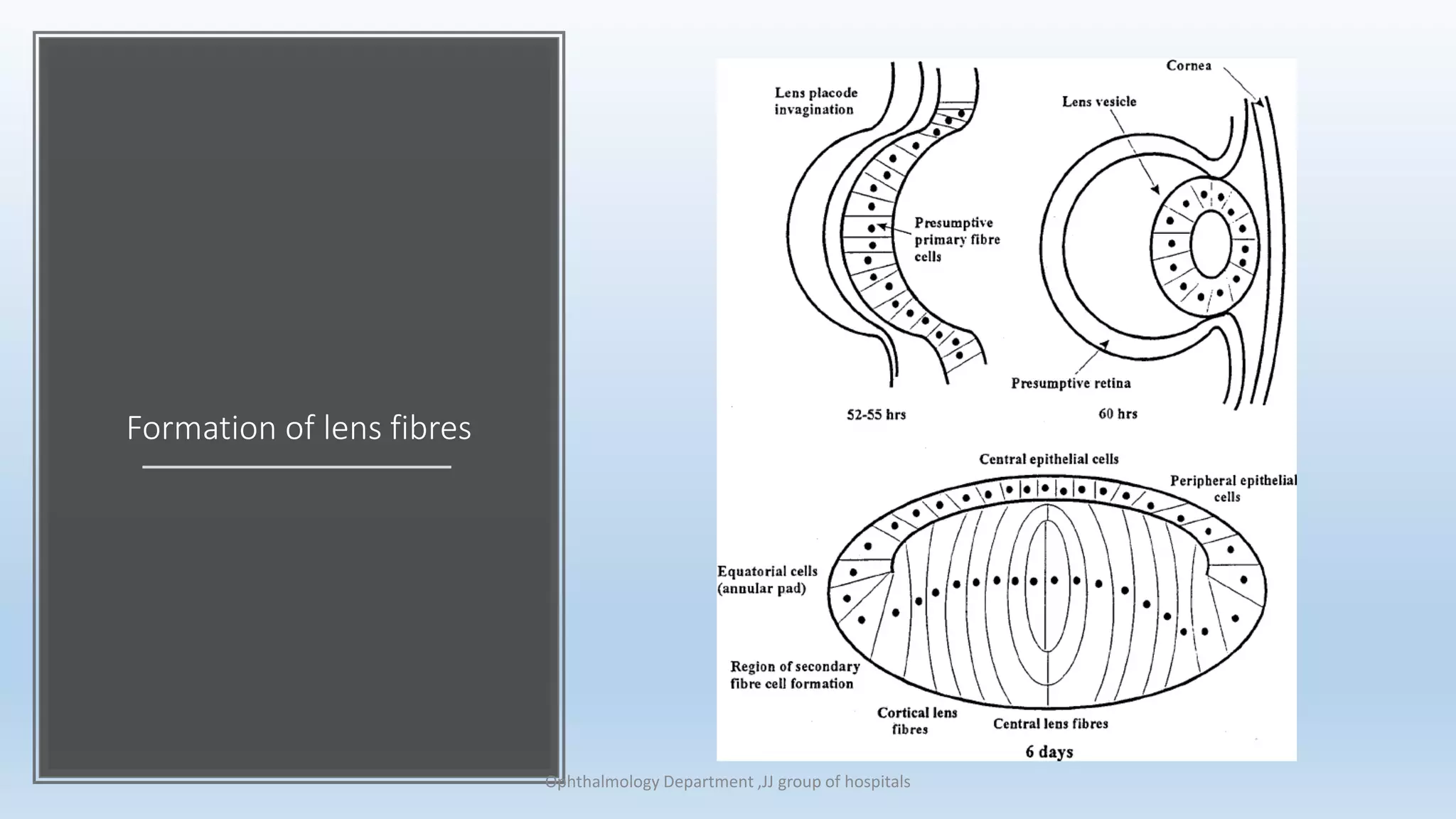 Pediatric (congenital, developmental) cataract and management ...
