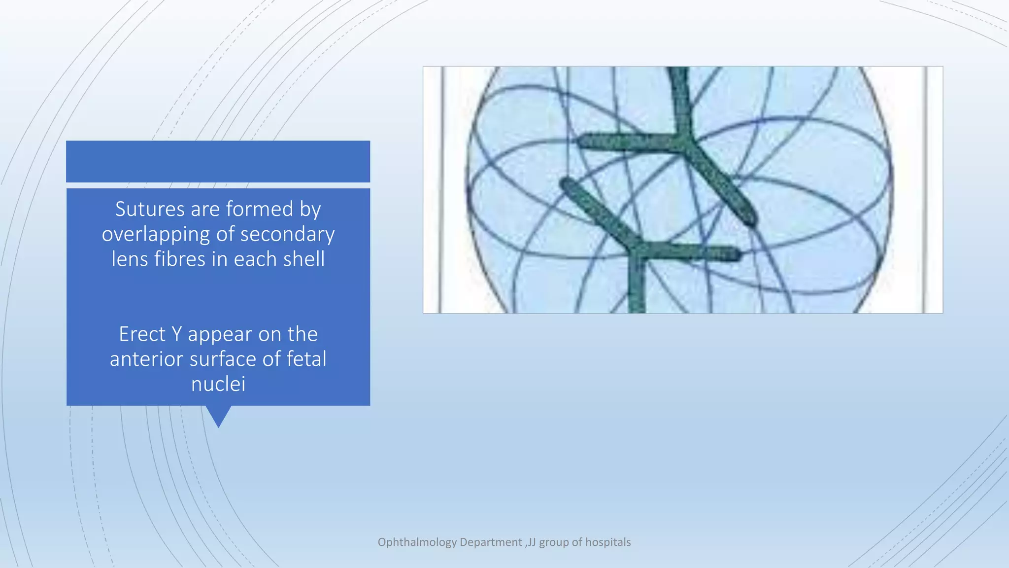 Pediatric (congenital, developmental) cataract and management ...