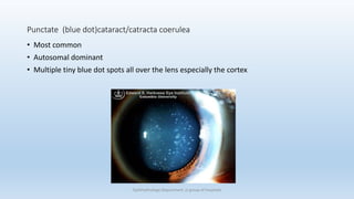 Pediatric (congenital, developmental) cataract and management ...