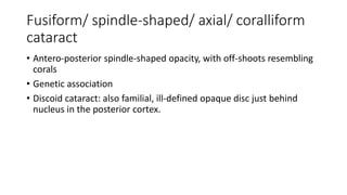 Congenital cataract | PPTX