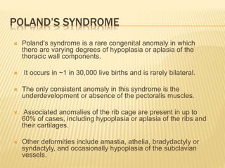 Congenital chest wall anomalies | PPTX